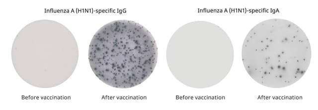 ELISA versus ELISpot: Which assay is right for your research? | Mabtech