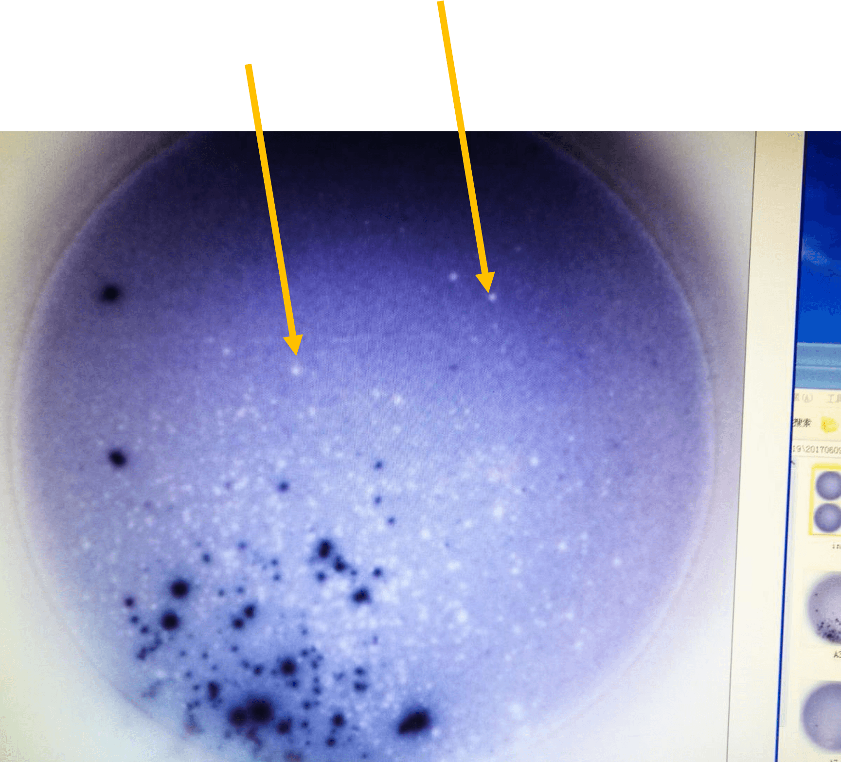 7 common ELISpot errors and how to avoid them | Mabtech