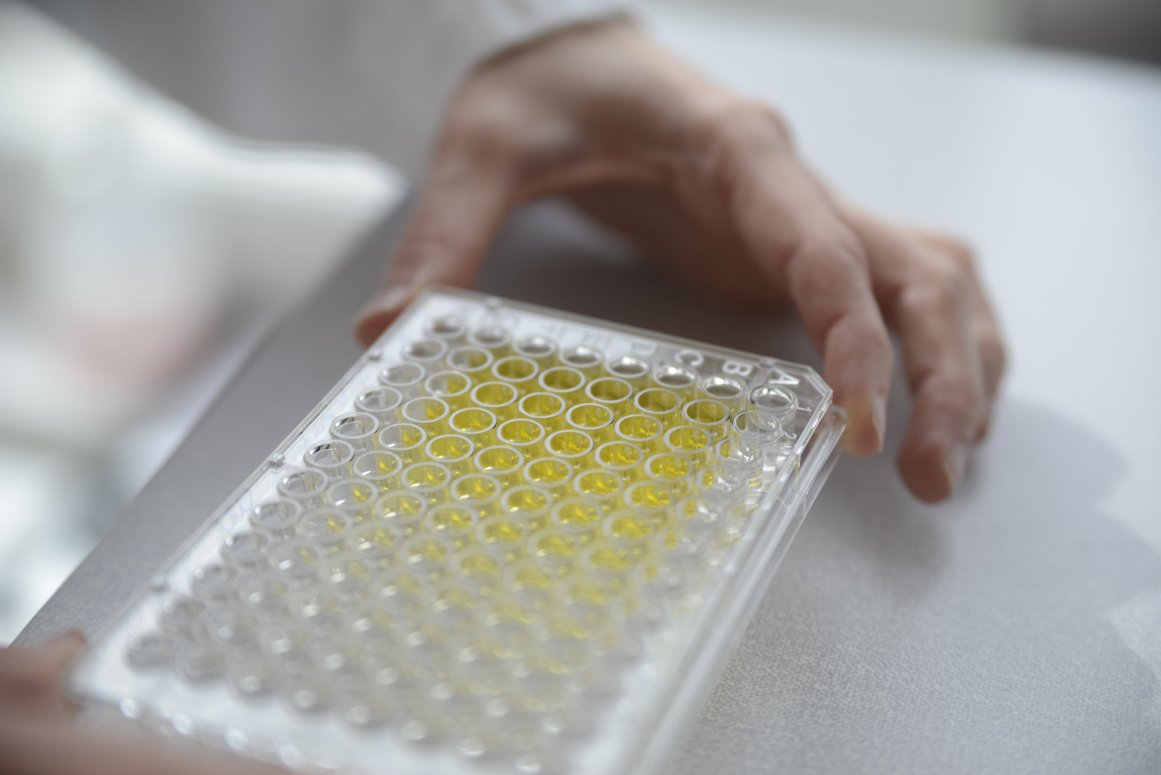 Human CD25 ELISA launched | Mabtech