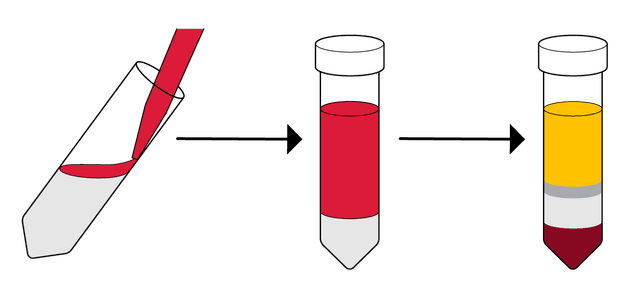 Isolation, freezing, and thawing of PBMCs | Mabtech