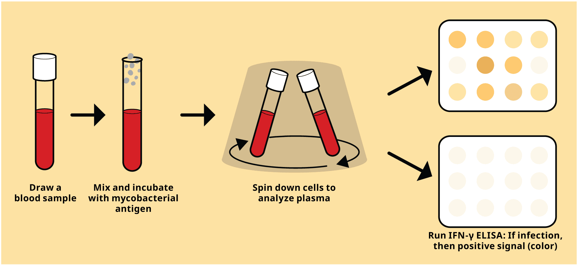 ELISpot vs ELISA: Superior sensitivity in TB diagnostics | Mabtech