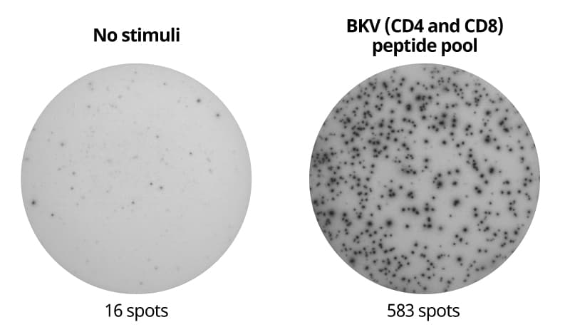 PepPool: BKV (CD4 and CD8), human - Mabtech