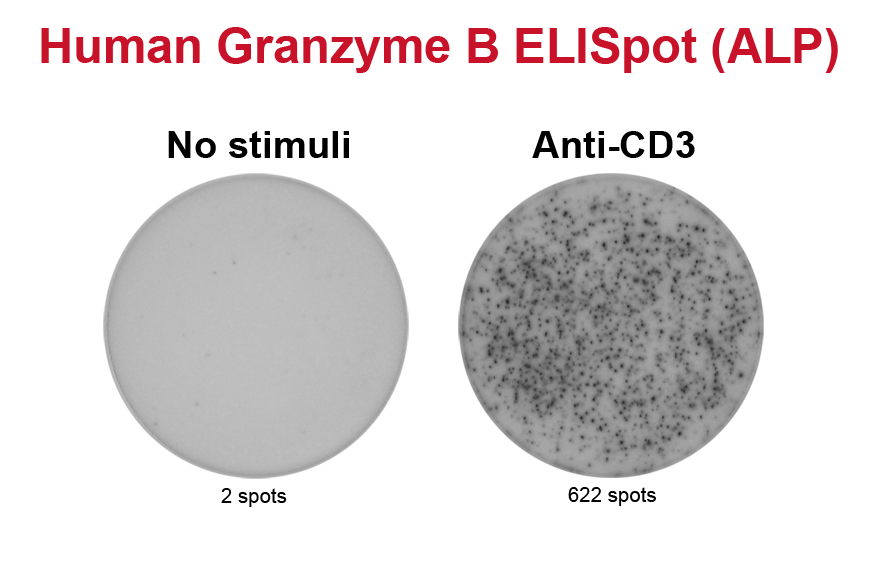 PBMC (62,500 cells/well) were incubated for 20 h in the absence or ...